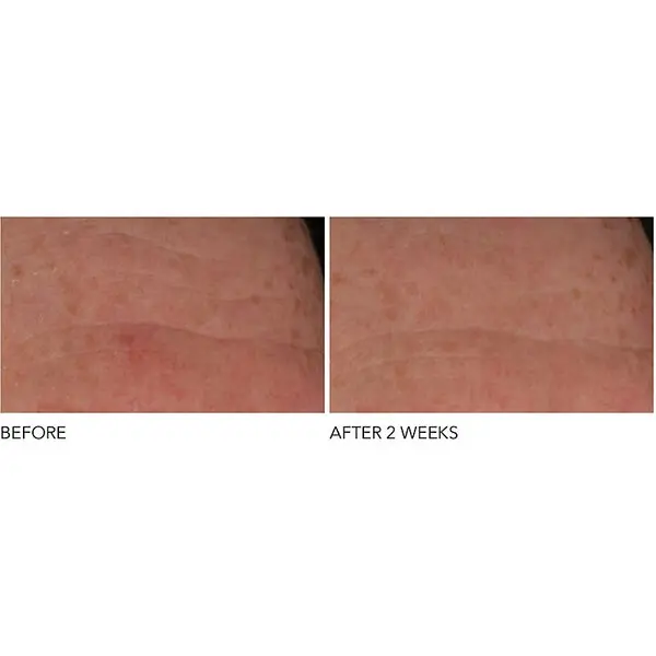 DR. DENNIS GROSS SKINCARE Advanced Retinol + Ferulic Overnight Wrinkle Treatment