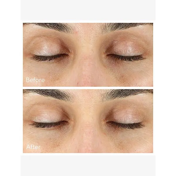 MURAD Vita-c Eyes Dark Circle Corrector 15ml - Na