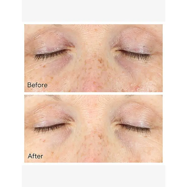 MURAD Vita-c Eyes Dark Circle Corrector 15ml - Na