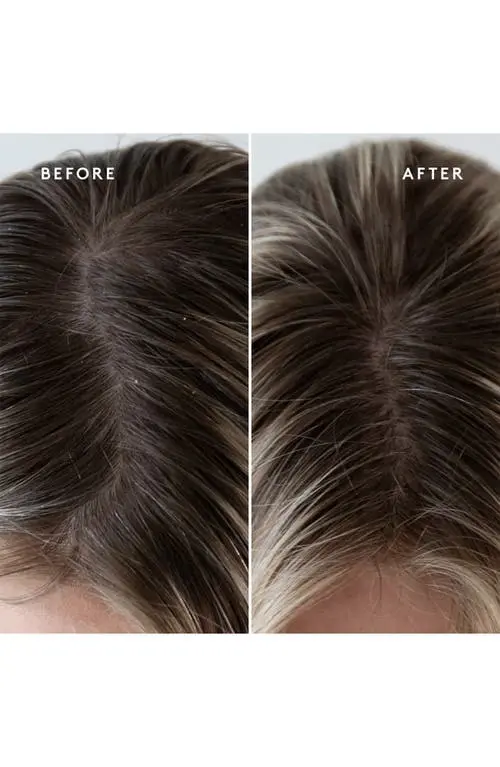 Virtue® Exfoliating Scalp Treatment