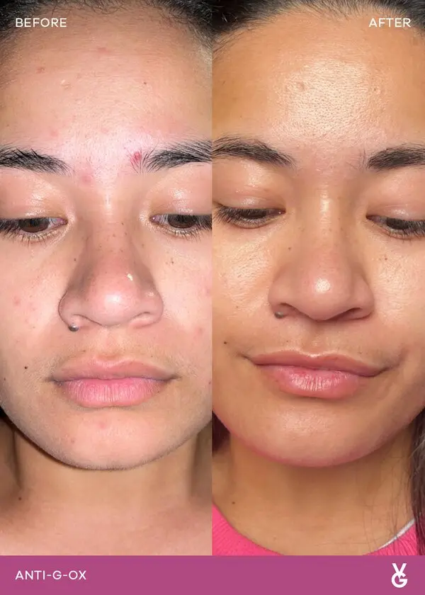 VIDA GLOW Anti-g-ox Berry, Supplements, Lace, Berry-flavoured