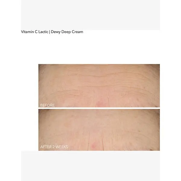 DR. DENNIS GROSS SKINCARE Vitamin C Lactic Dewy Deep Cream