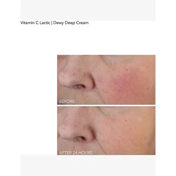 DR. DENNIS GROSS SKINCARE Vitamin C Lactic Dewy Deep Cream