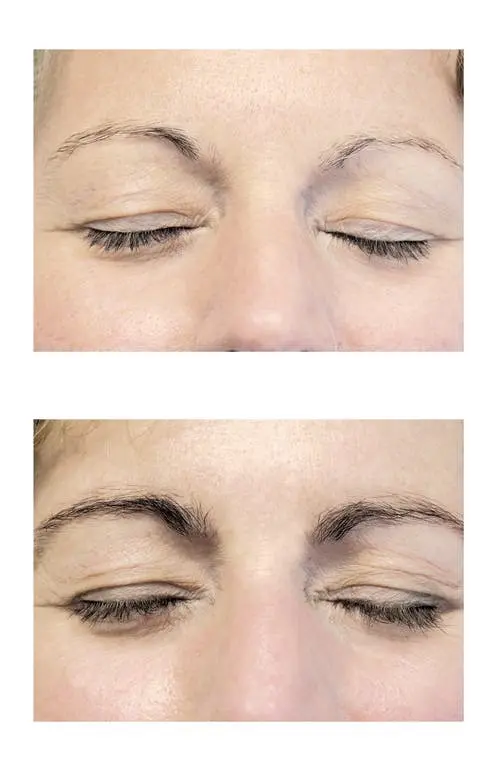 NeuLASH® Neubrow® Brow Enhancing Serum