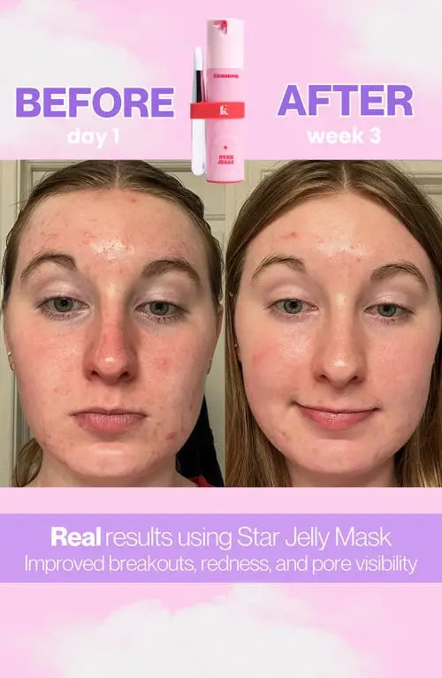 KIRAMOON Star Jelly Magic Resurfacing Facial