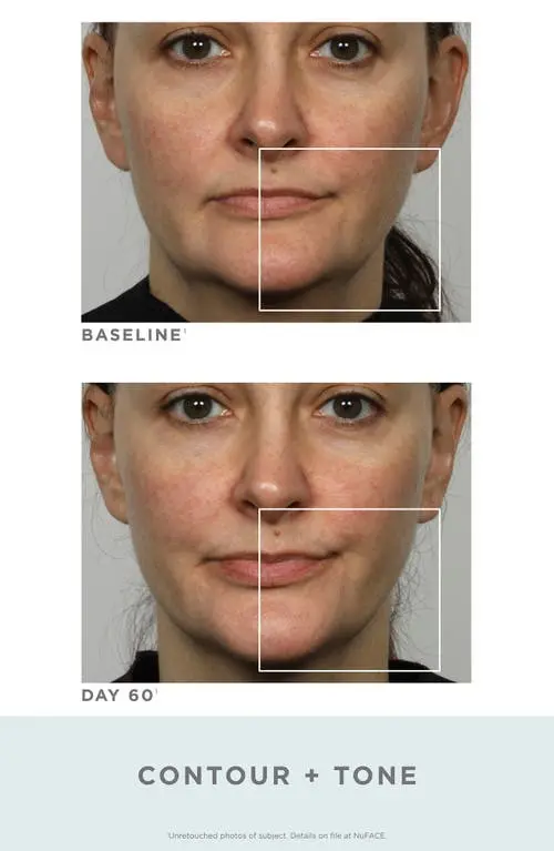 NUFACE® Trinity Facial Toning Device