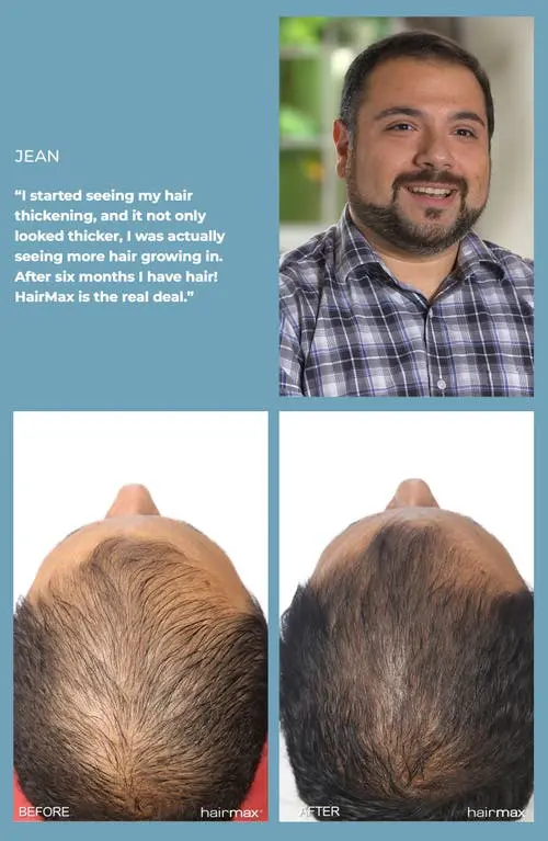 HAIRMAX LASERCOMB® Laserband 82 Comfortflex Hair Growth Device