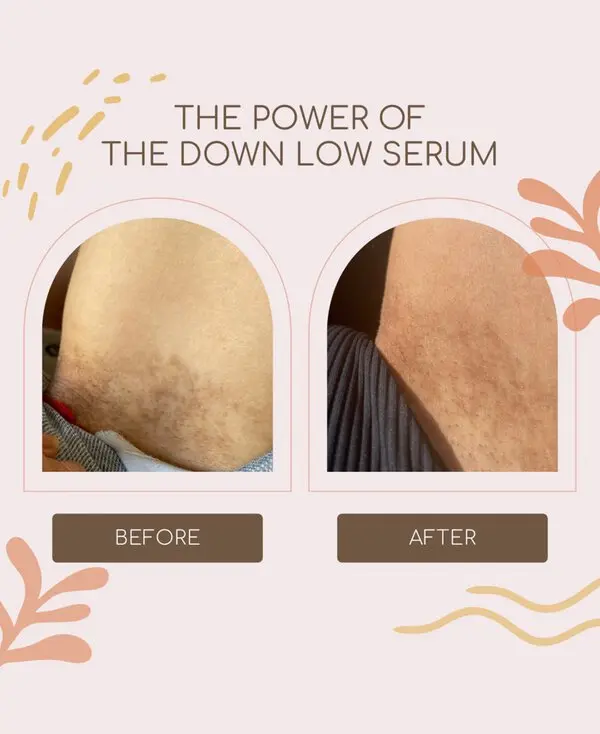 FORGOTTEN SKINCARE The Down Low Inner Thigh Serum