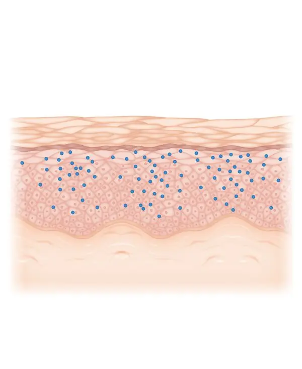 SOLARIS LABORATORIES NY Time Off Dissolving Hyaluronic Acid Microneedle Overnight Patch Treatment