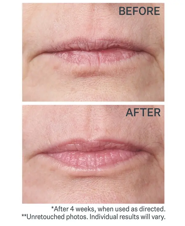 Strivectin Double Fix For Lips Plumping & Vertical Line Treatment - N,a