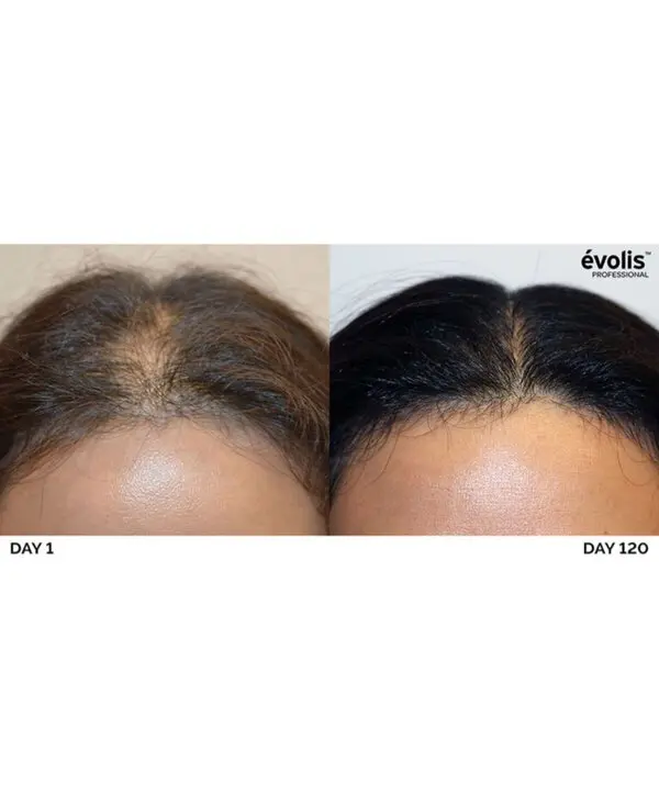 EVOLIS PROFESSIONAL Prevent Shampoo