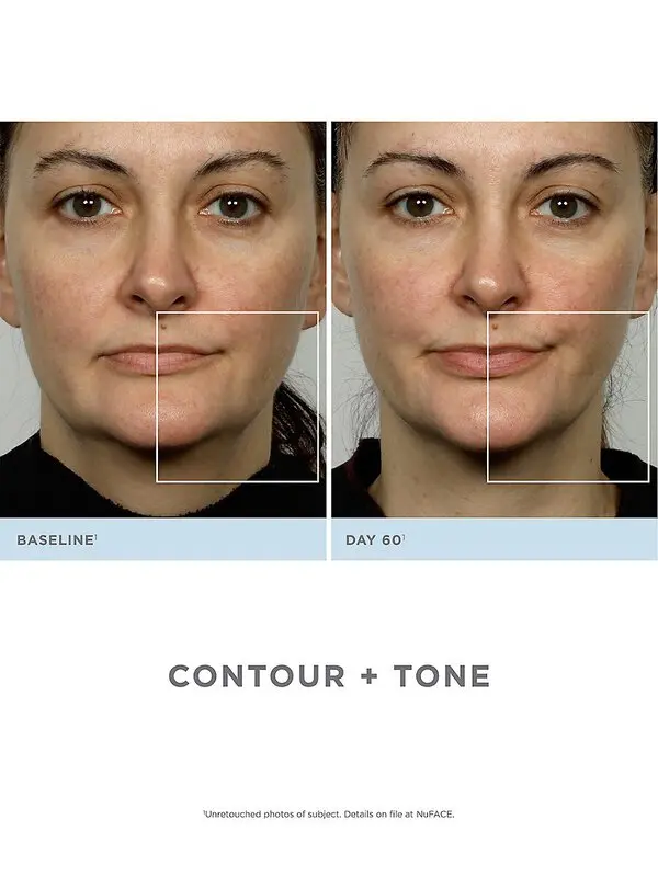 NuFACE Trinity Facial Toning Device Set