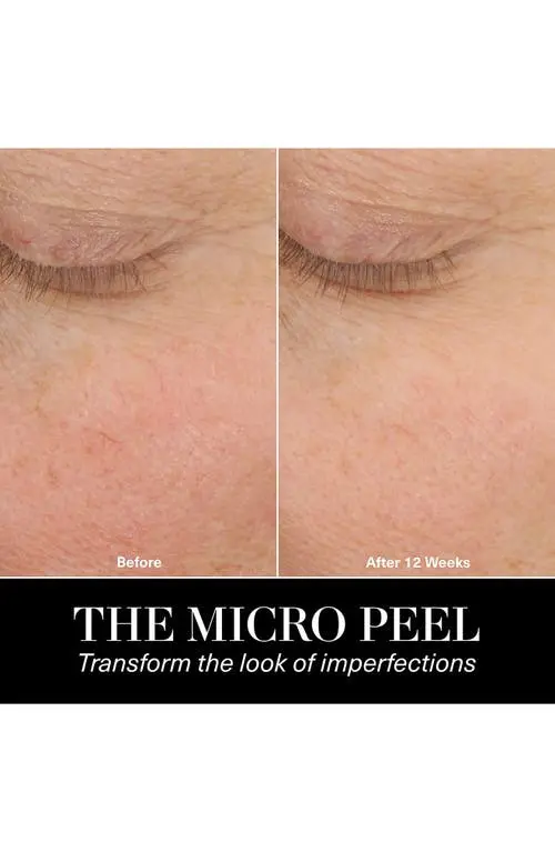 La Mer The Resurfacing Micro Peel Treatment For Anti-aging - No Color
