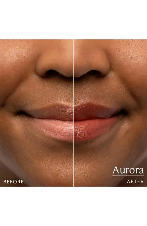 FRESH® Sugar Lip Treatment - Aurora Red