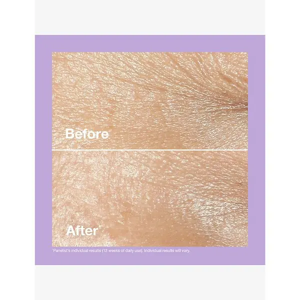 CLINIQUE Smart Clinical Repair™ Wrinkle Correcting Rich Cream