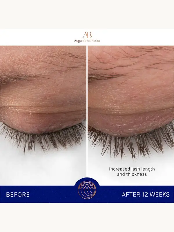Augustinus Bader The Eyebrow And Lash Enhancing Serum