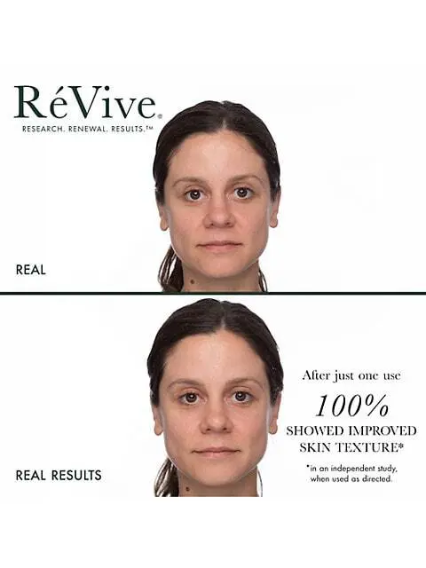 RéVive® Masque De Brilliance Resurfacing Multi-acid Mask