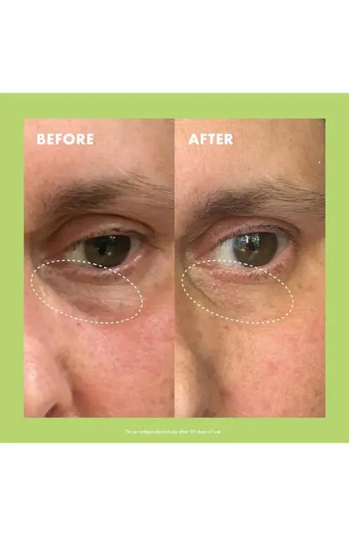 KOPARI BEAUTY Niacinamide & Caffeine Eye Bright Cream - No Color