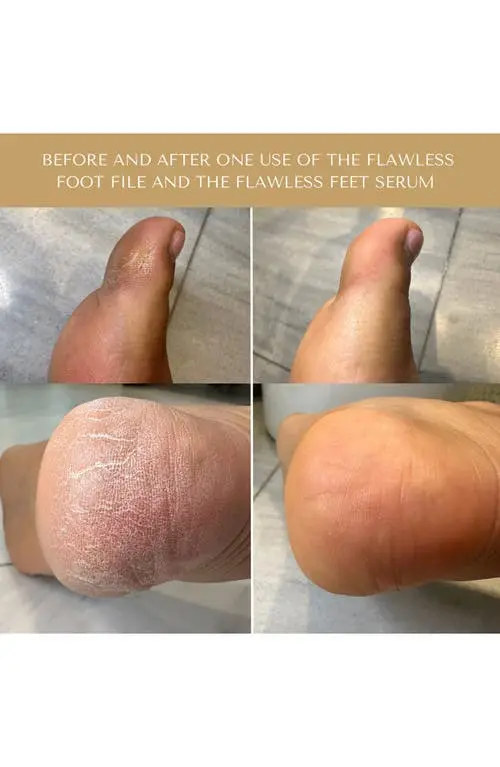 SERUM DOCTOR Flawless Feet System