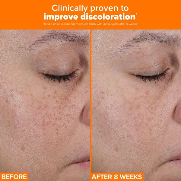glutathione target Amazon.com: SAM'U PDRN Ultimate Aura Target Serum main image 0