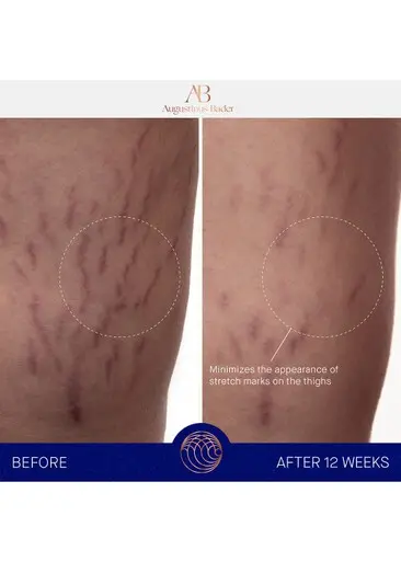 Augustinus Bader The Body Vegan Moisturiser Complex Of Natural Amino Acids - Cream