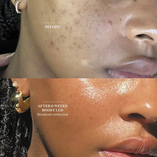 THE LIGHT SALON - Boost Led Mask