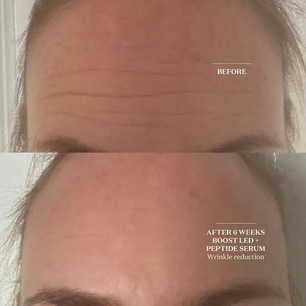 THE LIGHT SALON - Boost Led Mask