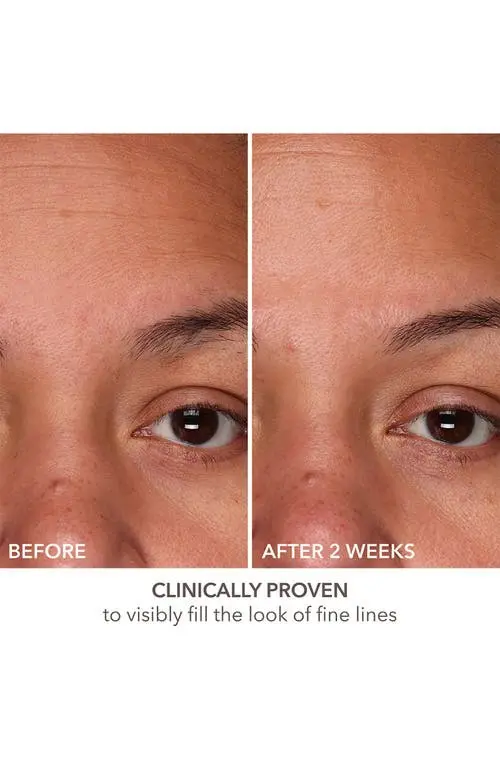 DR. DENNIS GROSS SKINCARE Derminfusions Fill + Repair Serum