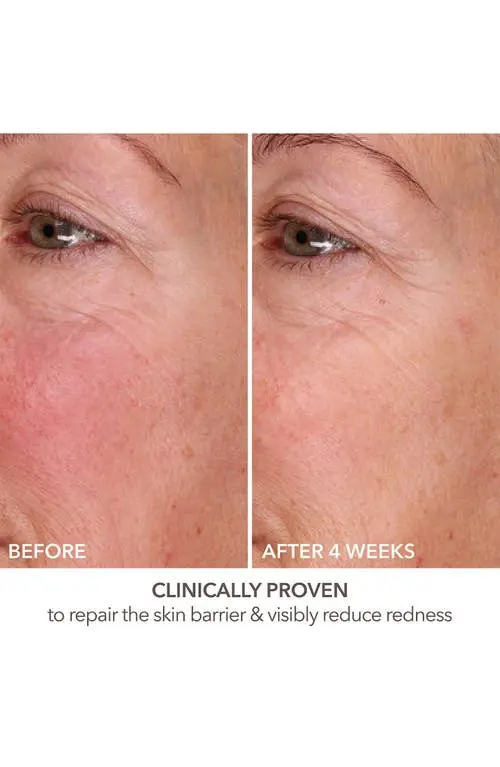 DR. DENNIS GROSS SKINCARE Derminfusions Fill + Repair Serum
