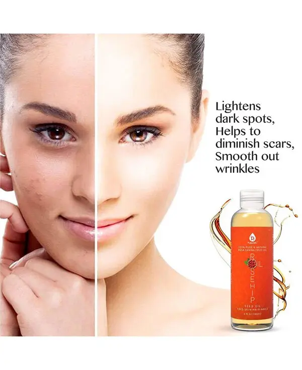 PURSONIC 100% Pure & Cold Pressed Premium Rosehip Seed Oil 6 Oz - Orange