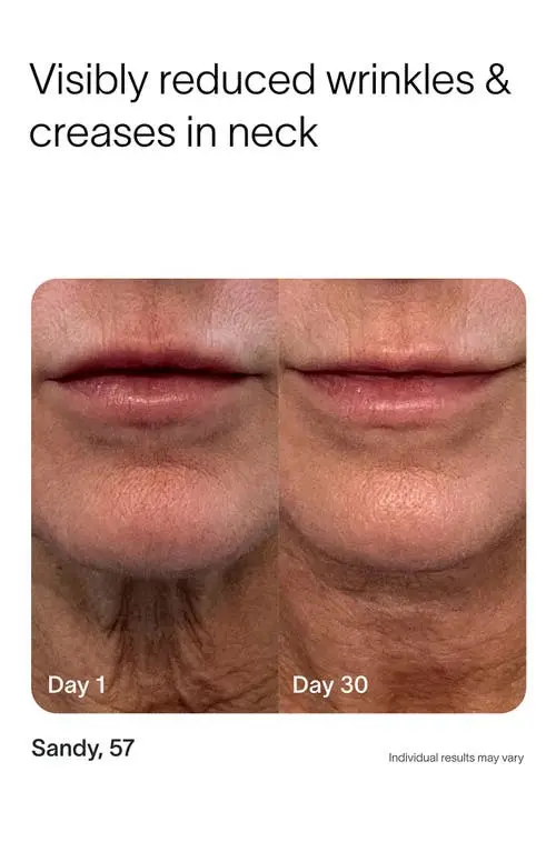 SOLAWAVE 4-in-1 Skin Care Wand - Charcoal