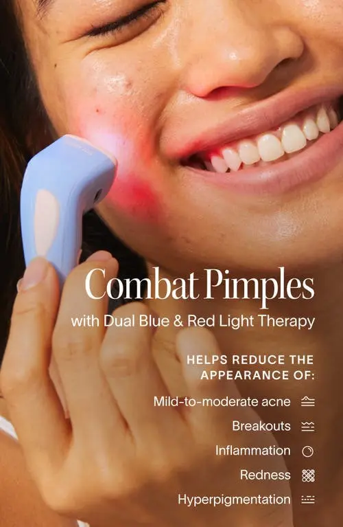 SOLAWAVE 3 Minute Light Therapy Acne Spot Treatment