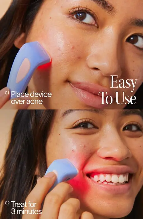 SOLAWAVE 3 Minute Light Therapy Acne Spot Treatment