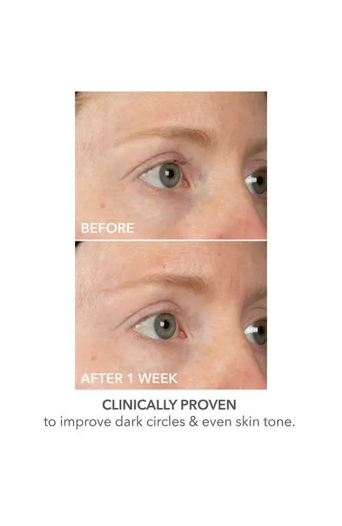 DR. DENNIS GROSS SKINCARE Derminfusions Lift + Repair Eye Mask