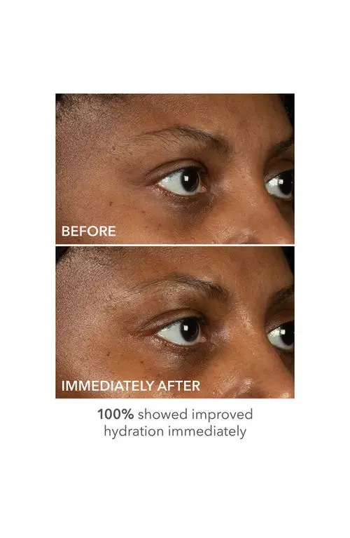DR. DENNIS GROSS SKINCARE Derminfusions Lift + Repair Eye Mask