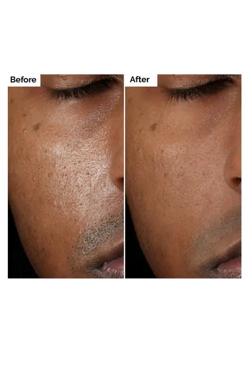 THE ORDINARY Aloe 2% + Nag 2% Solution For Post-acne Marks - No Color