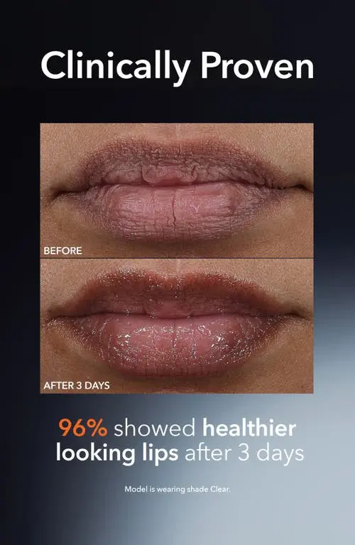 DR. DENNIS GROSS SKINCARE Derminfusions™ Plump + Repair Lip Treatment - Beige