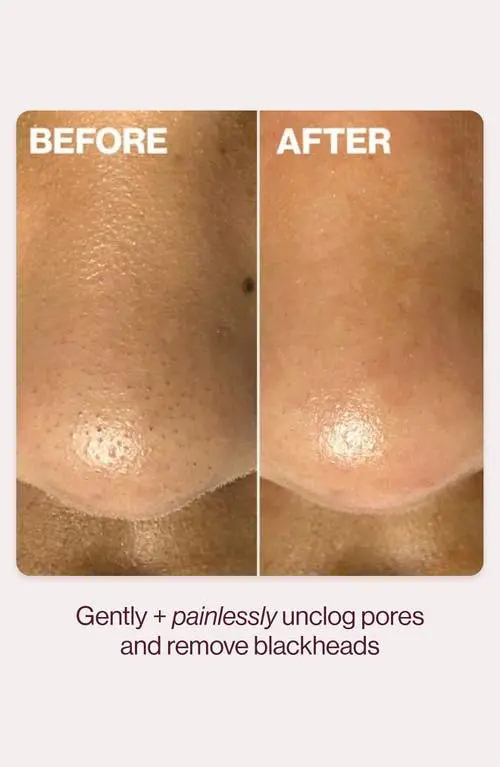 DERMAFLASH Dermapore+ Ultrasonic Pore Extractor + Skincare Infuser - Peach Fuzz