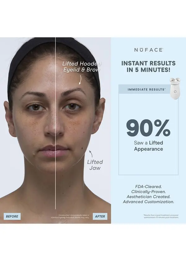 NUFACE Trinity+ Wrinkle Reducer Attachment