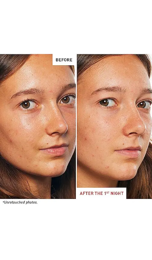 ERBORIAN Skin Therapy Multi-perfecting Night Oil-serum - N,a