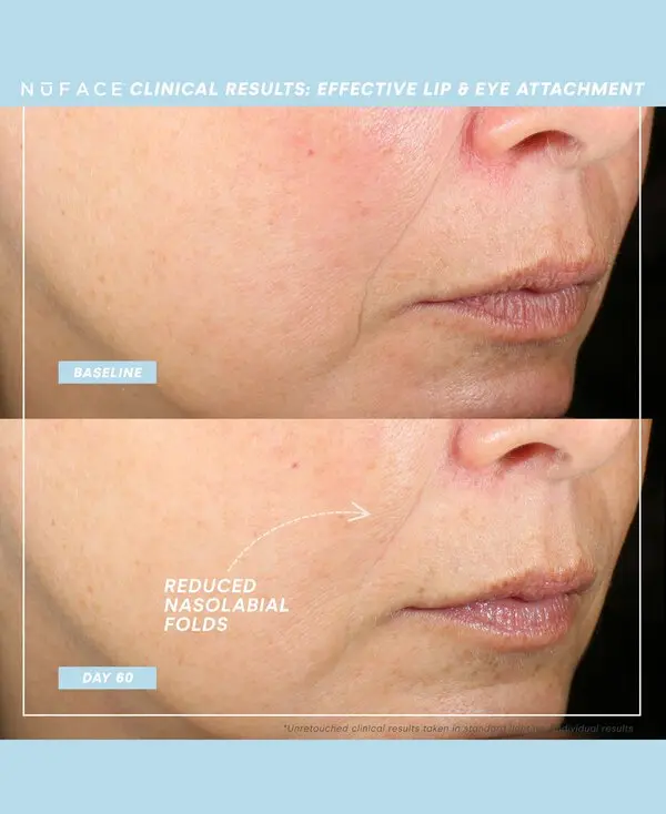 NuFACE Effective Lip & Eye Attachment - No Color