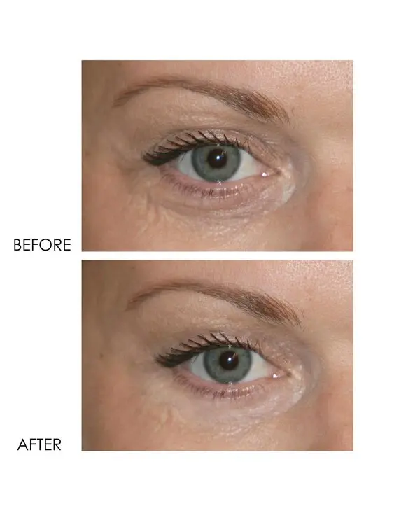 DERMELECT Revitalite Professional Eyelid & Dark Circle Corrector - Open Miscellaneous