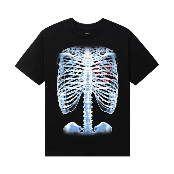 ANTI SOCIAL SOCIAL CLUB Bones Tee - Black