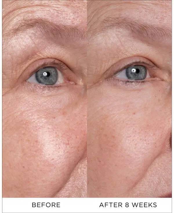 NOBLE PANACEA The Exceptional Eye Lift Concentrate - No Color