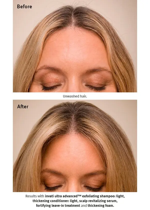 Aveda Invati Ultra Advanced System