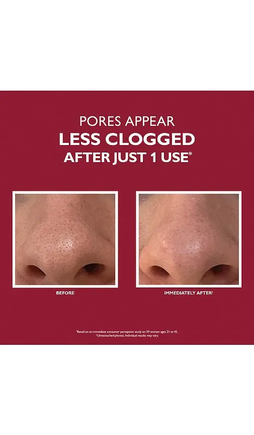 PETER THOMAS ROTH Even Smoother Microdermabrasion Exfoliating Pore Treatment - N,a