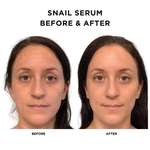INTOXICATED COSMETICS Snail Serum + Hat Bundle | 1 Fl Oz/ 30 Ml | Anti-aging Formula With Vegan Snake Peptides | Hydrating Hyaluronic Acid
