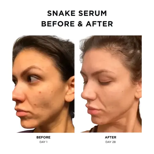 INTOXICATED COSMETICS Snake Serum + Antidote Moisturizer | Anti-aging Formula With Vegan Snake Peptides & Fine Line Smoothing