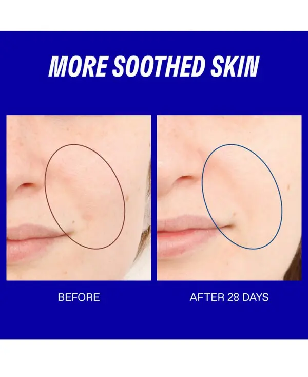 KORRES Greek Yoghurt Skin-supplement Serum - None