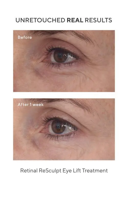 MURAD Retinal Resculpt Eye Lift Treatment - None